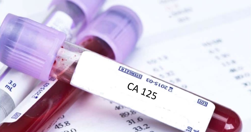 The Introvert: CA-125 Tumor Marker