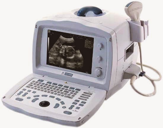 Memahami Pemeriksaan Ultrasound (USG) pada