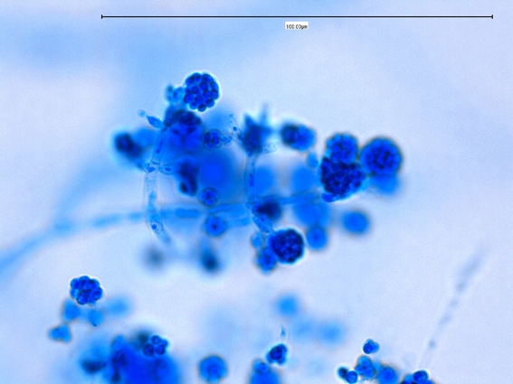 Fun With Microbiology (What's Buggin' You?): Trichoderma species