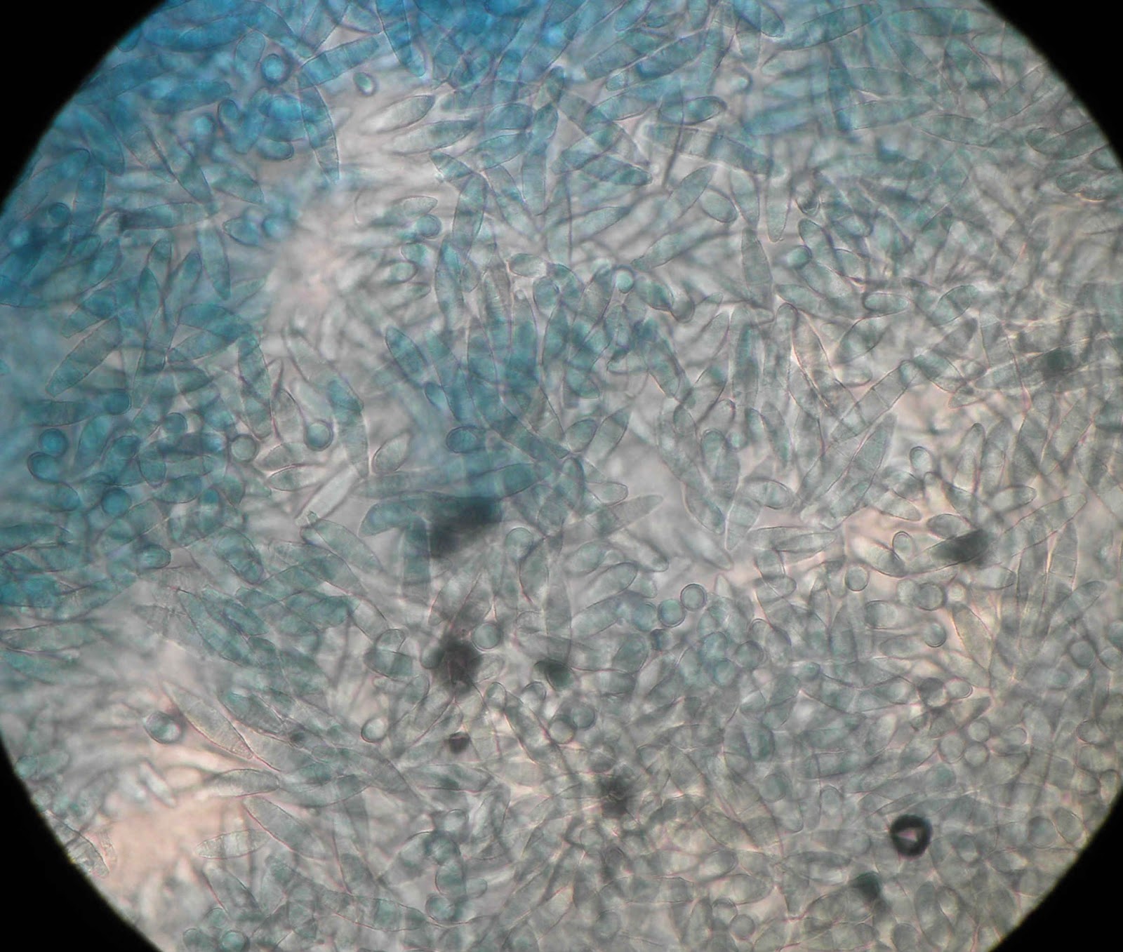 ATLAS MICOLOGIA: MICROSPORUM GYPSEUM