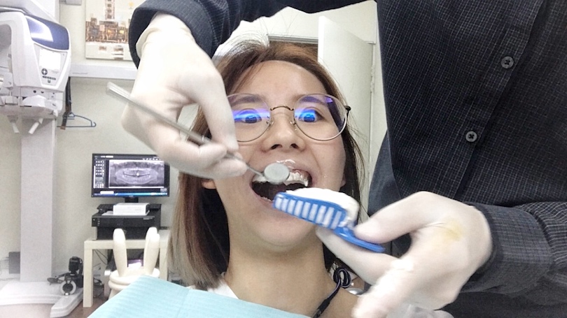 MY BRACES STORY #6: Take off braces, Retainer Mold , Invisalign ...