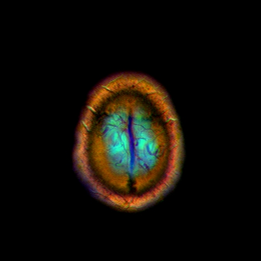 Nevit's blog: Color MRI of the Brain