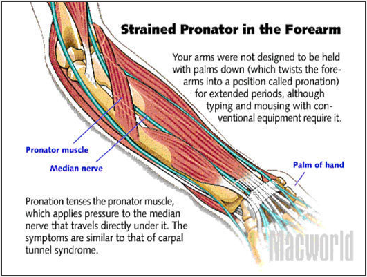 Picture Of Forearm Tendons : Tennis and Golfers elbow - What's the ...