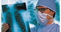 Merokok dan Asap Rokok Menjadi Punca Utama Kanser Paru-paru