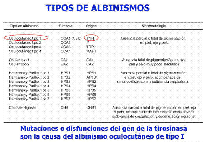 ALBINISMO OCULOCUTÁNEO: TIPOS DE ALBINISMO