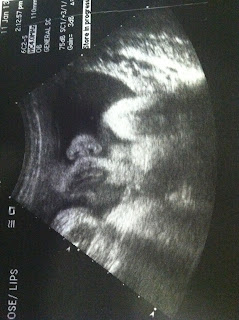 {baby olson} : 35 Weeks: January & Maternity Photoshoot!!