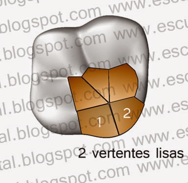 Características anatômicas do primeiro molar superior direito Dente 16