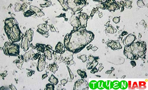 Atlas of Miscellaneous images in urine | Free Medical Atlas