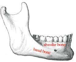Basal implants