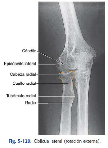 PRODUCCION Y TRATAMIENTO DE IMAGENES DIAGNOSTICAS: CAPITULO EXTREMIDAD