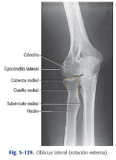 PRODUCCION Y TRATAMIENTO DE IMAGENES DIAGNOSTICAS: CAPITULO EXTREMIDAD