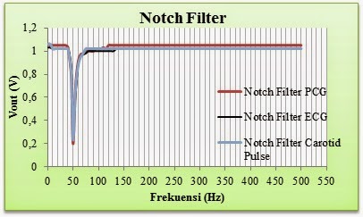 Teknologi dan Inovasi: Pemahaman Elektrokardiografi (EKG) dan cara ...