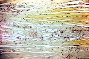 QUÍMICO-BIÓLOGO: Tejido Conjuntivo