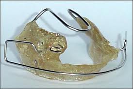 APARATOLOGIA ORTOPEDICA: BIONATOR CLASE III