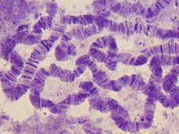 my_biology: GIANT CHROMOSOME ( KROMOSOM RAKSASA ) PADA Drosophila ...