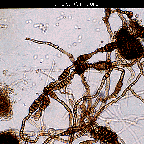 Sustainable Mycology: June 2016