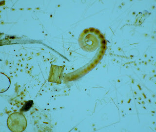 Buzz's Marine Life of Puget Sound: LATE SUMMER PLANKTON