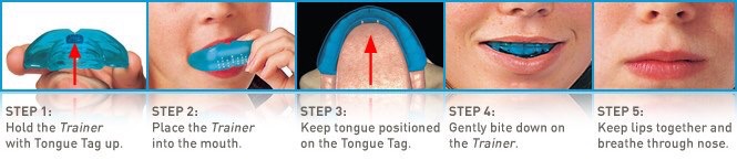 Teeth Trainer Alignment | Ortho Trainer | WA 0812-810-800-20