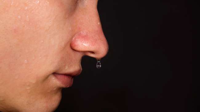 PANDUAN KESEHATAN KELUARGA: BERKERINGAT BERLEBIHAN