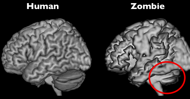 Aditum ad cognitionem: El Cerebro de un Zombie y cómo librarte de uno ...