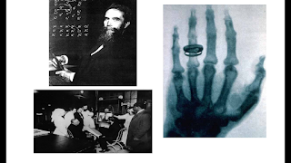 Introducción a la Radiología : HISTORIA DE LOS RAYOS X