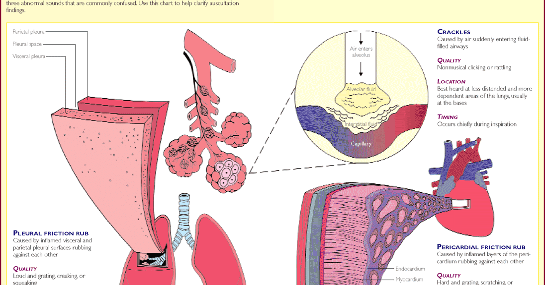 World Diseases Treatment Lung Diseases Affecting The Chest Wall