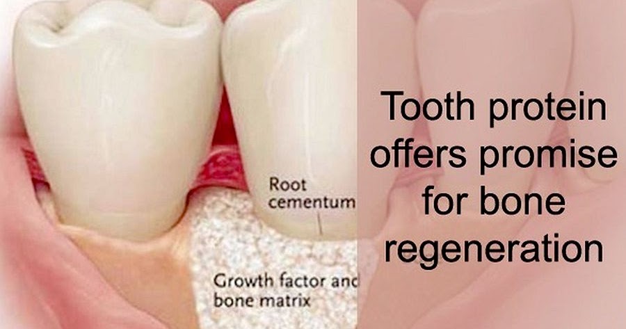 DENTAL NEWS: Tooth protein offers promise for bone regeneration - Ovi ...