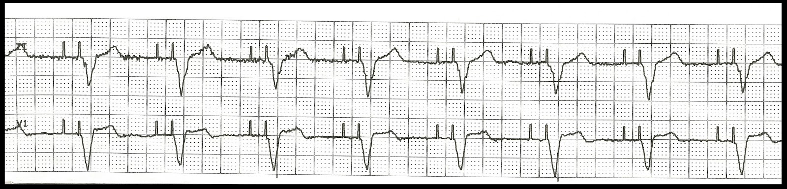 Practice EKG Rhythm Strips 101