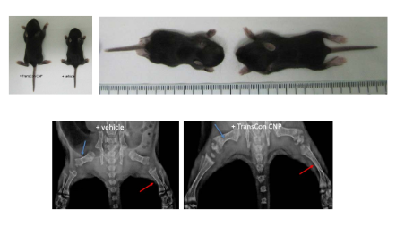 Treating Achondroplasia: Treating achondroplasia: TransCon CNP showed ...