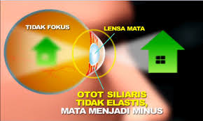 Jual Kaca Mata Terapi IBRITE Murah | prodiabet obat penyakit gula