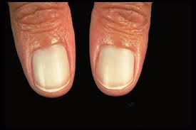 Ana Cristina Diniz - Dermatologia Estética - Cosmetic Dermatology: O ...