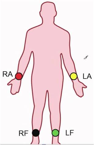 Medsign: Dasar-dasar EKG: Bagian 1
