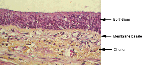 L'asthme de A à E: Le mucus bronchique