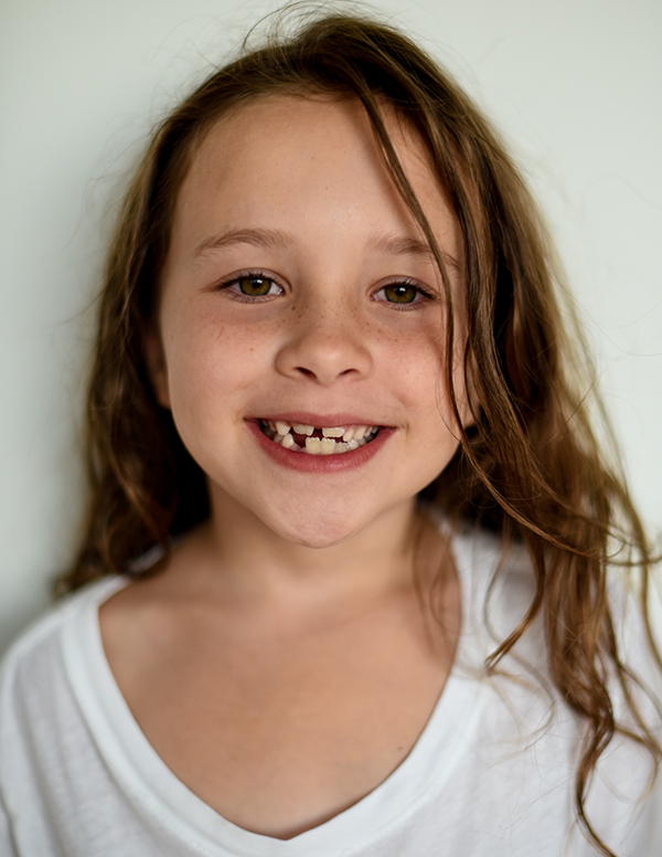 cahnicles: Big Girl Teeth