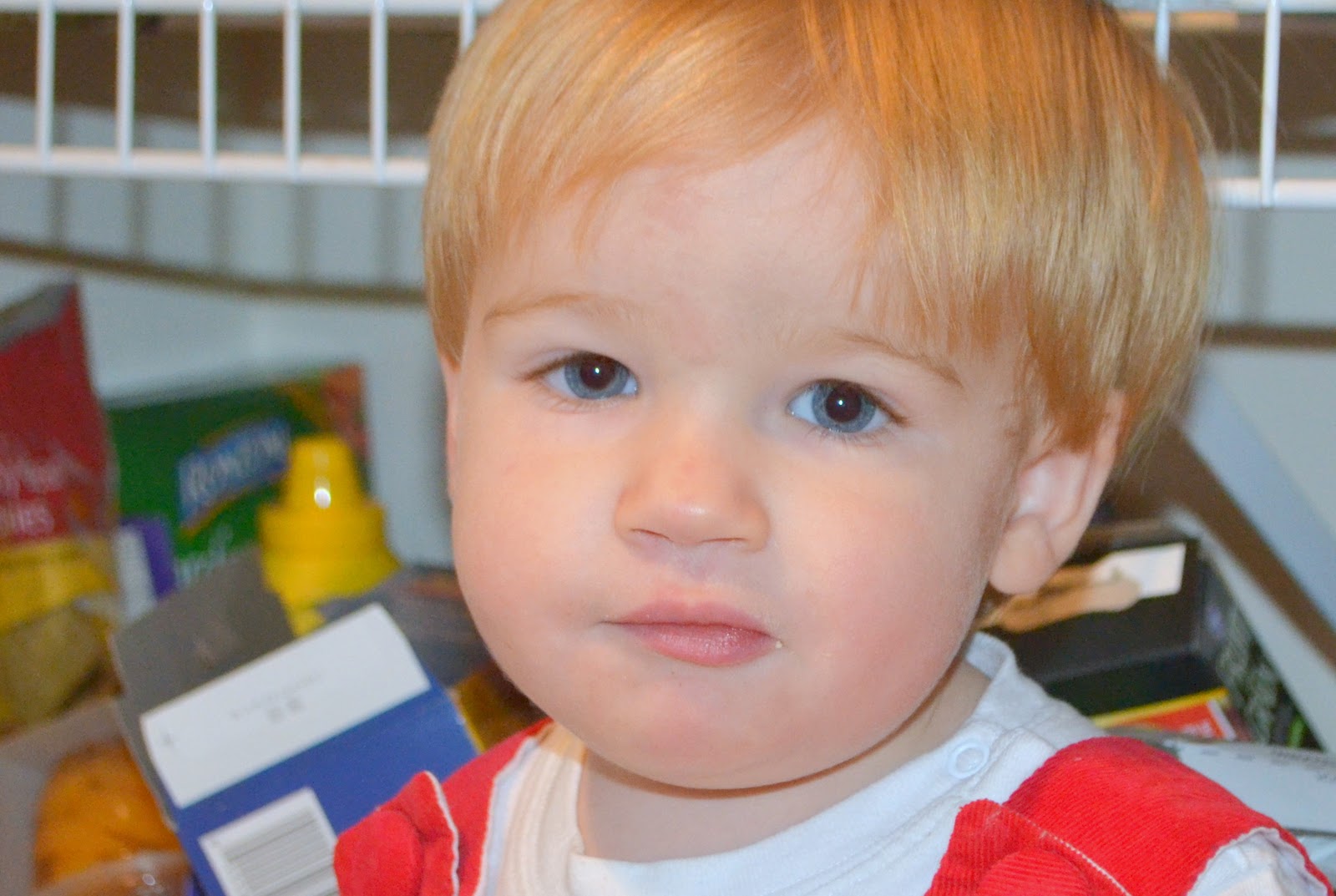 Thomas Jolley - Duane Syndrome, Klippel Feil Syndrome and Beyond: Those ...