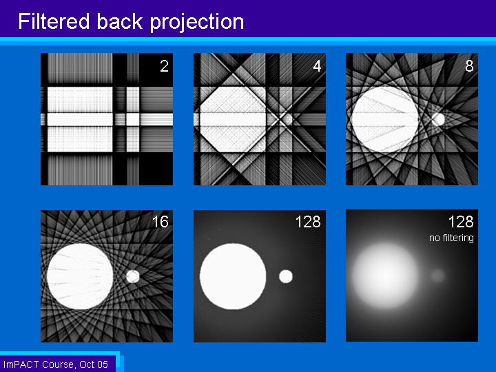 Basic principles of CT scanning ~ ct.scan.