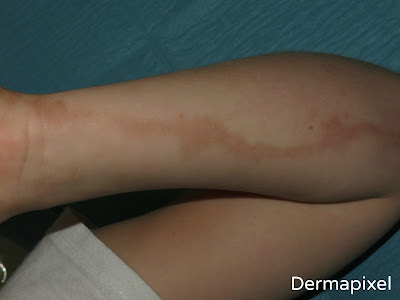 Dermapixel: julio 2017