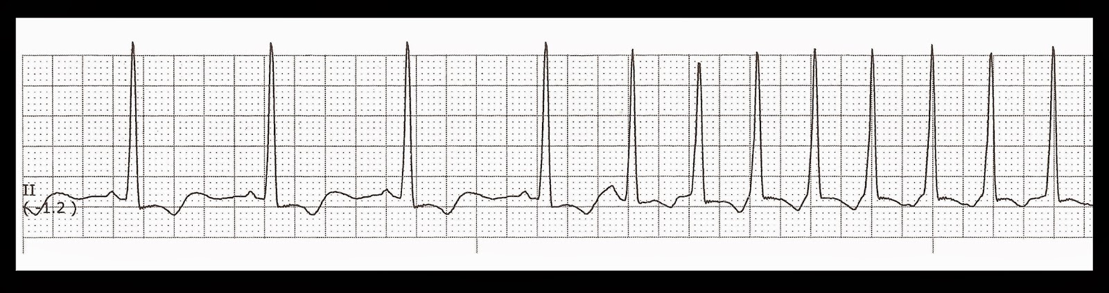 Practice EKG Strips 372