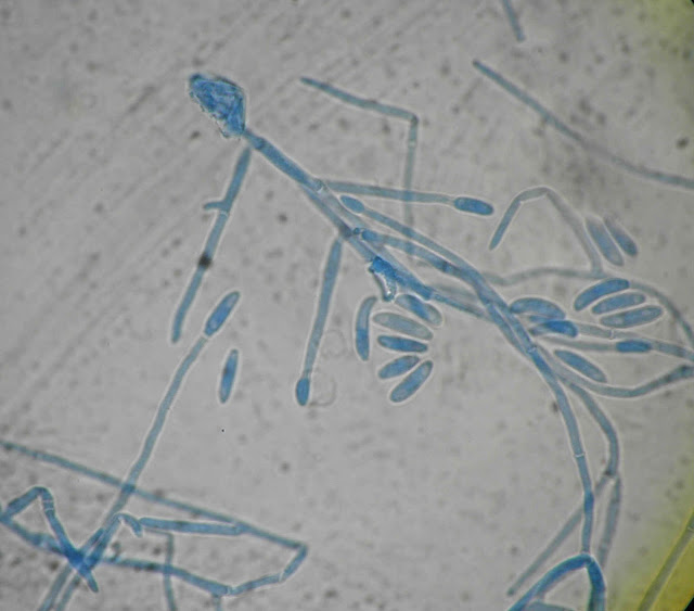 ATLAS MICOLOGIA: abril 2016