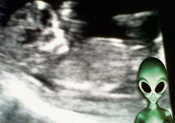 Novos Insólitos - Notícias incríveis que nos fazem refletir: Grávida ...