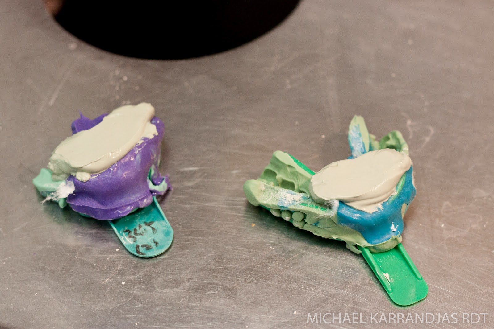 Dental Lab Model Pouring | Making Noise And Drinking Beer