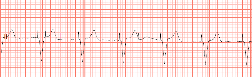 EKG Quiz 329
