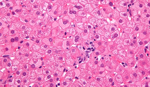 Liječenje prirodnim putem: Ćelija jetre - hepatocit