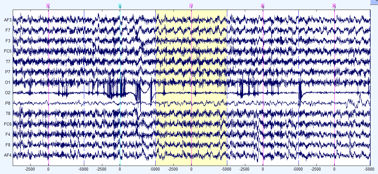 Viktor on Neuroinformatics: EEG data analysis of audio induced fear
