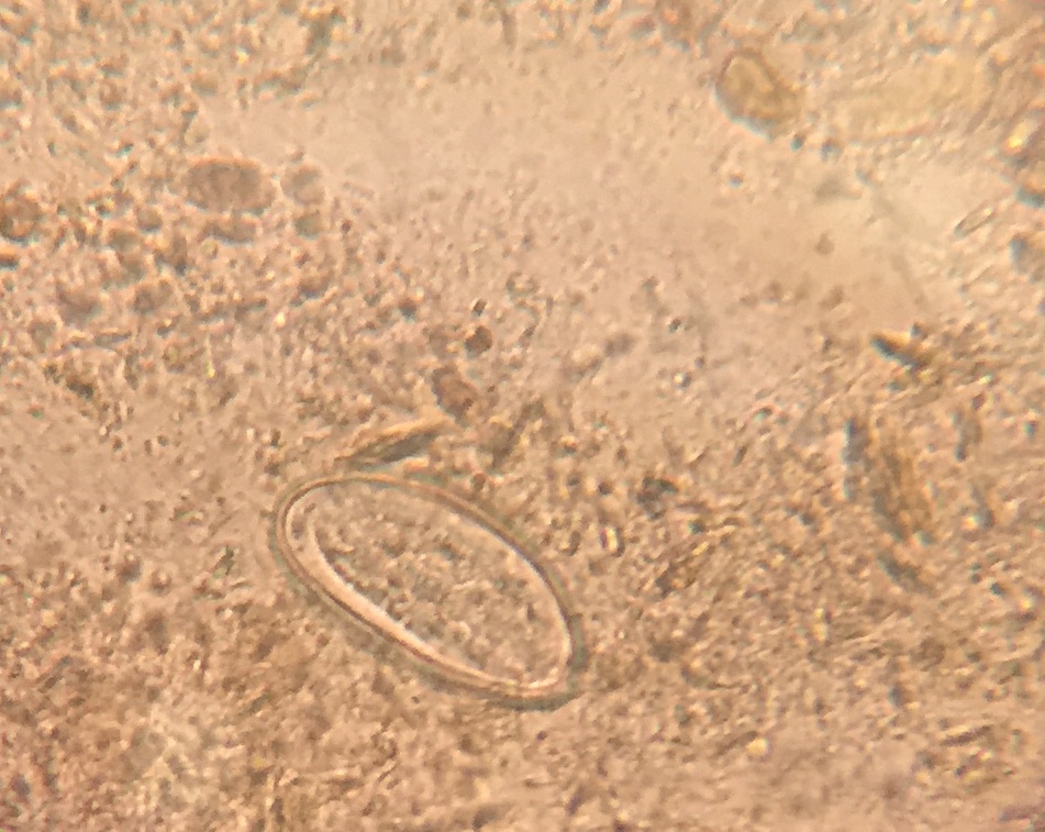 Z życia diagnosty laboratoryjnego: Owsiki