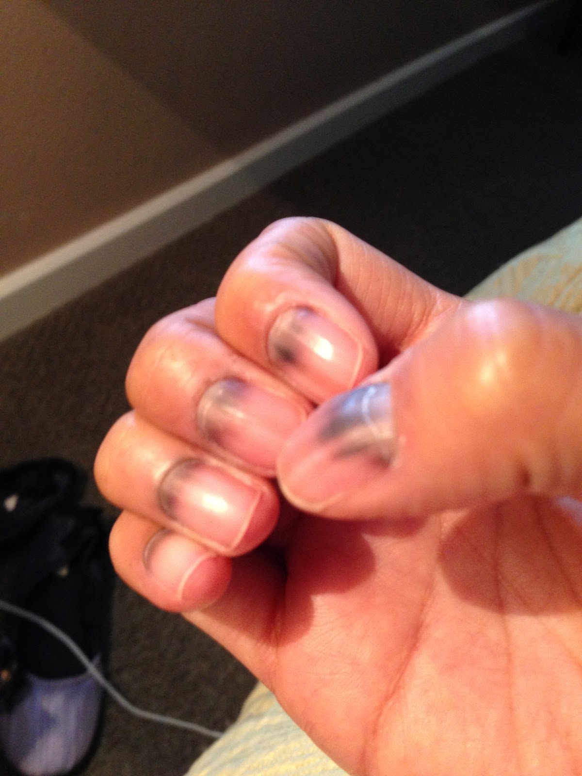 Chemo: What Is Red Devil Chemo