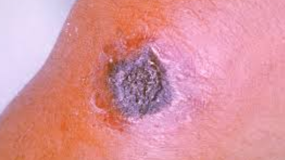 Blog Belajar Beternak: Penyakit anthrax pada sapi