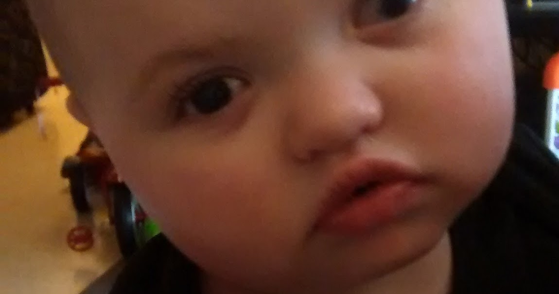 A Natural Slice of Life: What is the World is WAGR Syndrome?