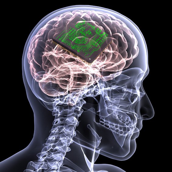 Brain Points: Memory Brain Implant