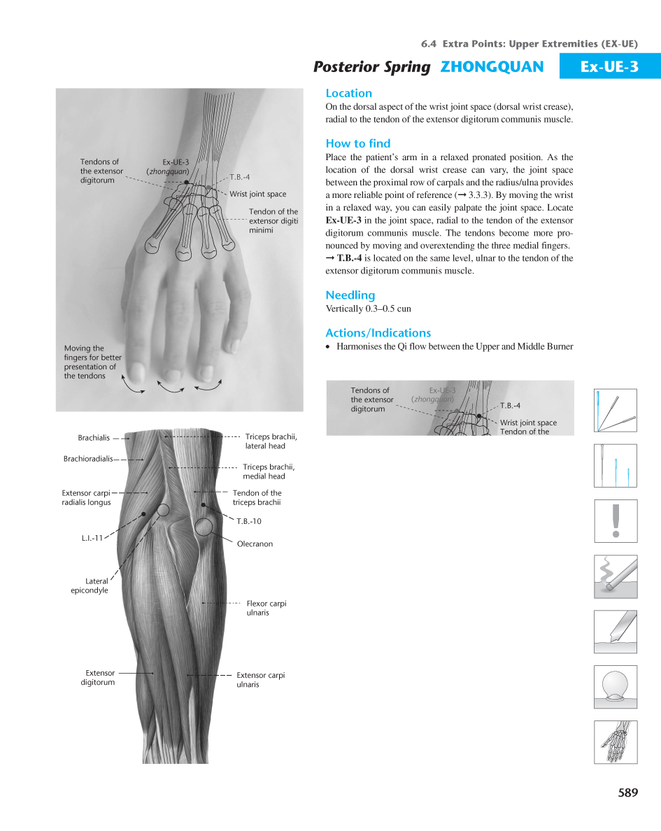 Acupuncture Masters: Acupuncture Points Database - Extra Points